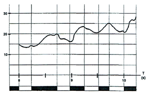 Biomechanical Observations in Hammer Throwing – Distinguishing the ...